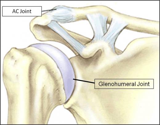 Acromioclavicular Joint Separation AC Separation Orland Park Acromioclavicular Joint Separation AC Separation Orland Park